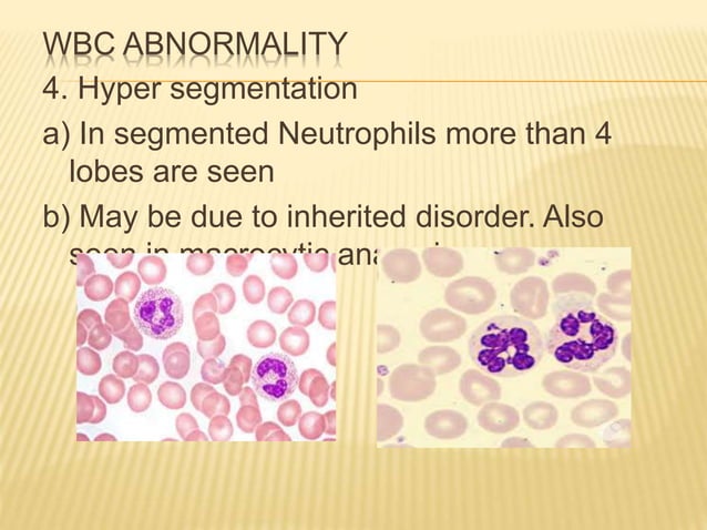 Wbc abnormality | PPT