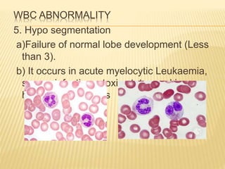 Wbc abnormality | PPTX
