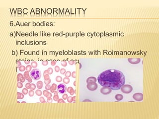 Wbc abnormality | PPTX