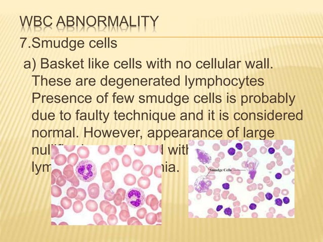 Wbc abnormality | PPT