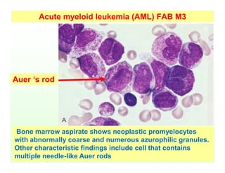 Wbc disoders practical | PDF