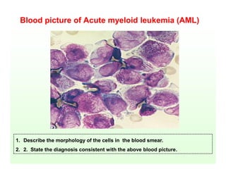Wbc disoders practical | PDF