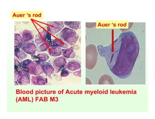 Wbc disoders practical | PDF