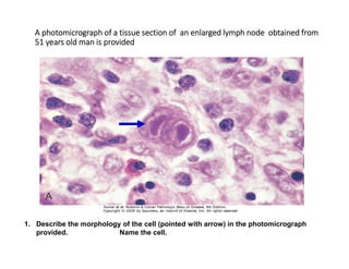 Wbc disoders practical | PDF