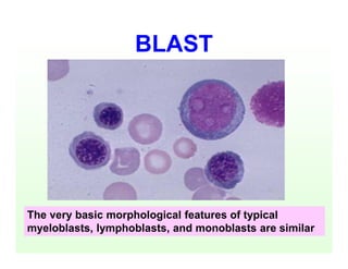 Wbc disoders practical | PDF