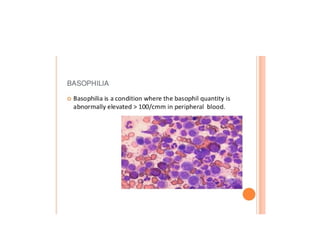 WBC DISORDERS.pptx by Dr Priyanka Gupta, MD Pathology | PPTX