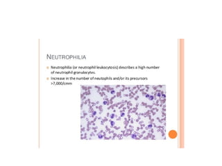 WBC DISORDERS.pptx by Dr Priyanka Gupta, MD Pathology | PPTX