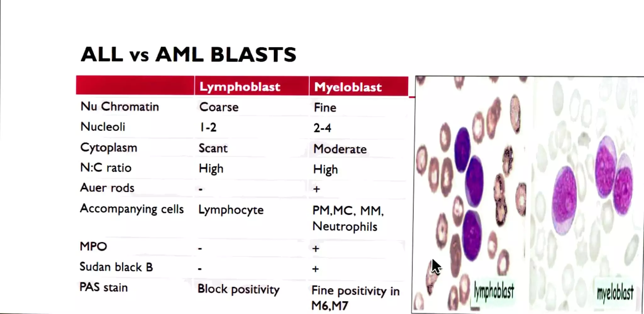 Wbc disorders 2 pathology | PDF