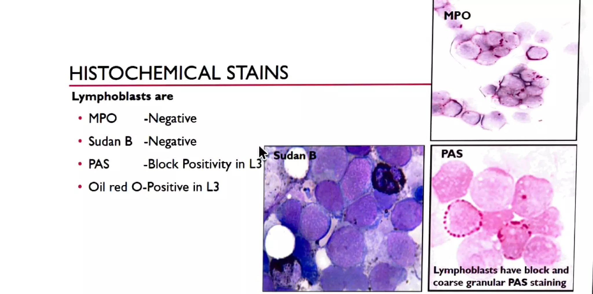 Wbc disorders 2 pathology | PDF