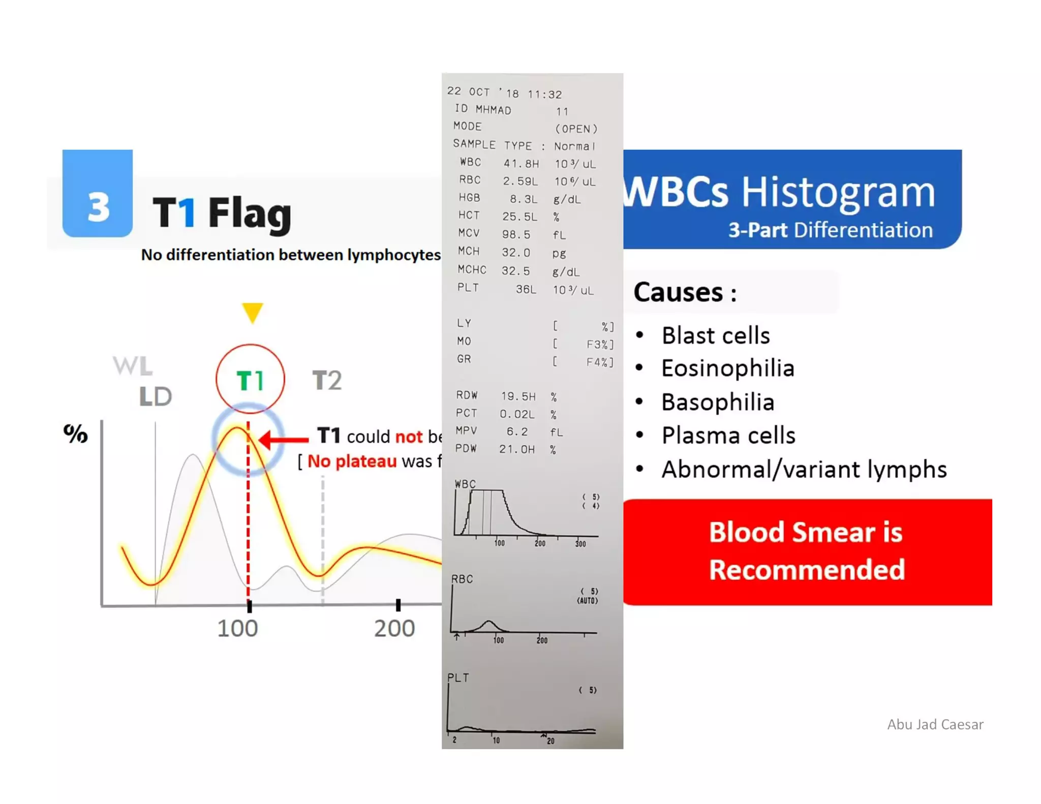 WBC Histogram | PDF
