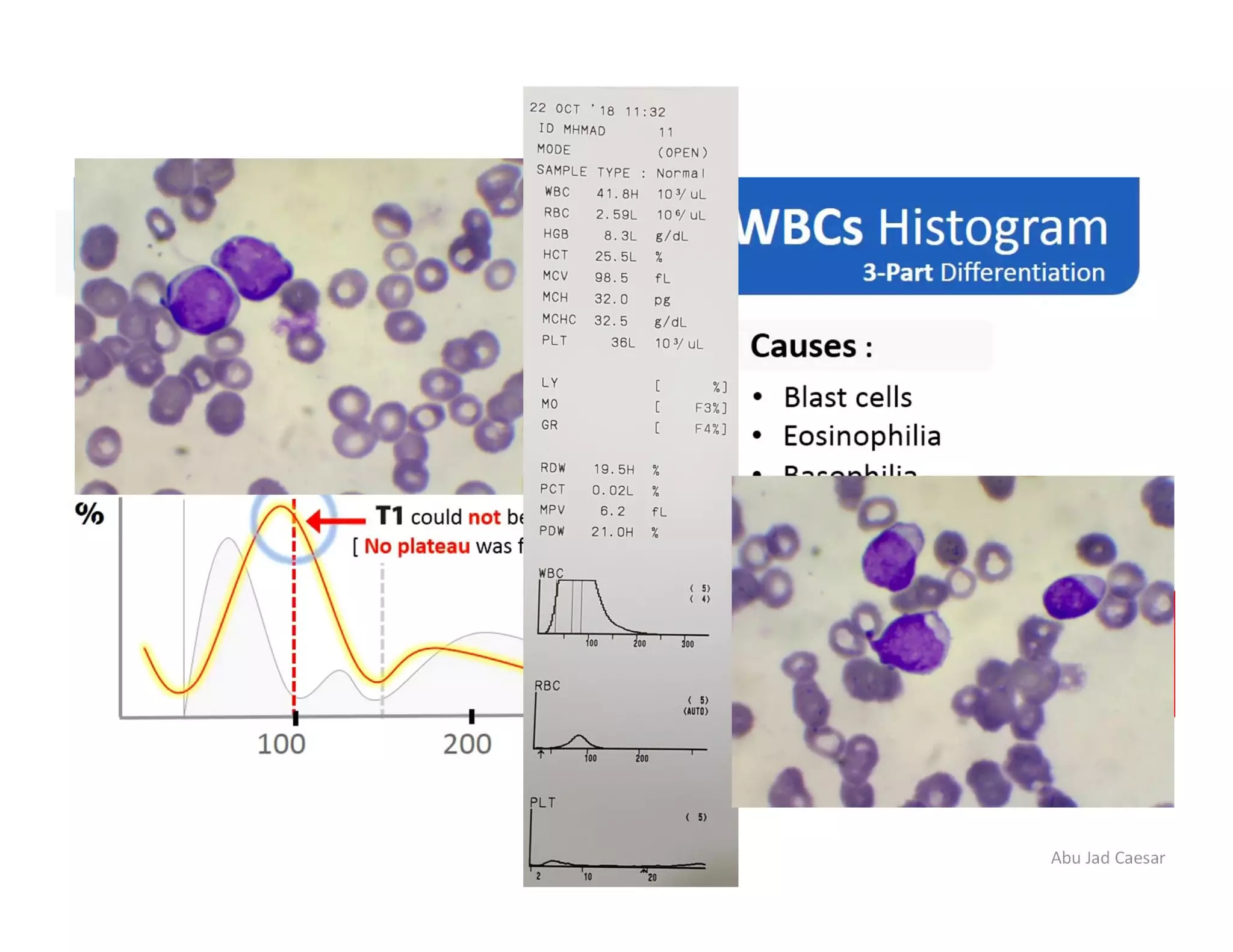 WBC Histogram | PDF
