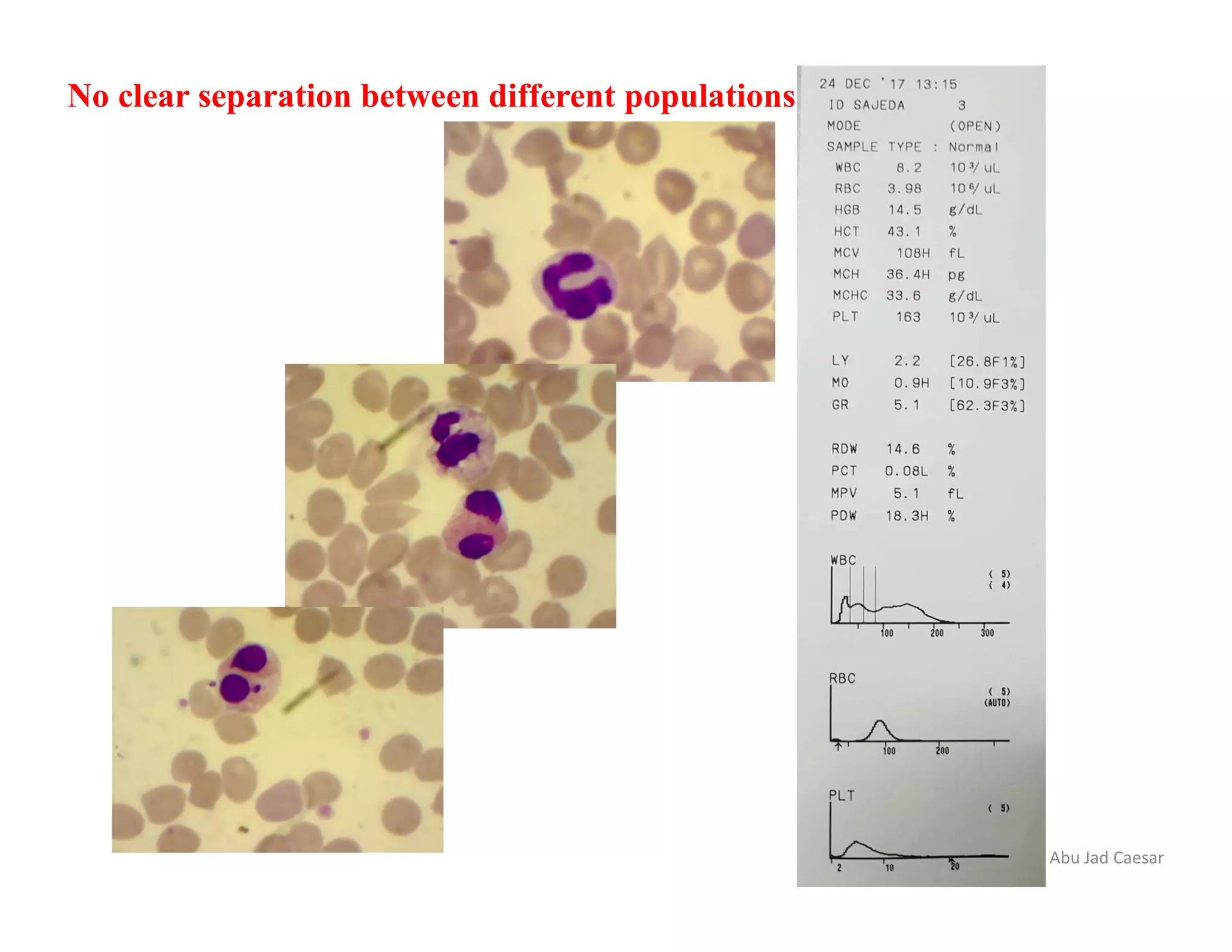WBC Histogram | PDF