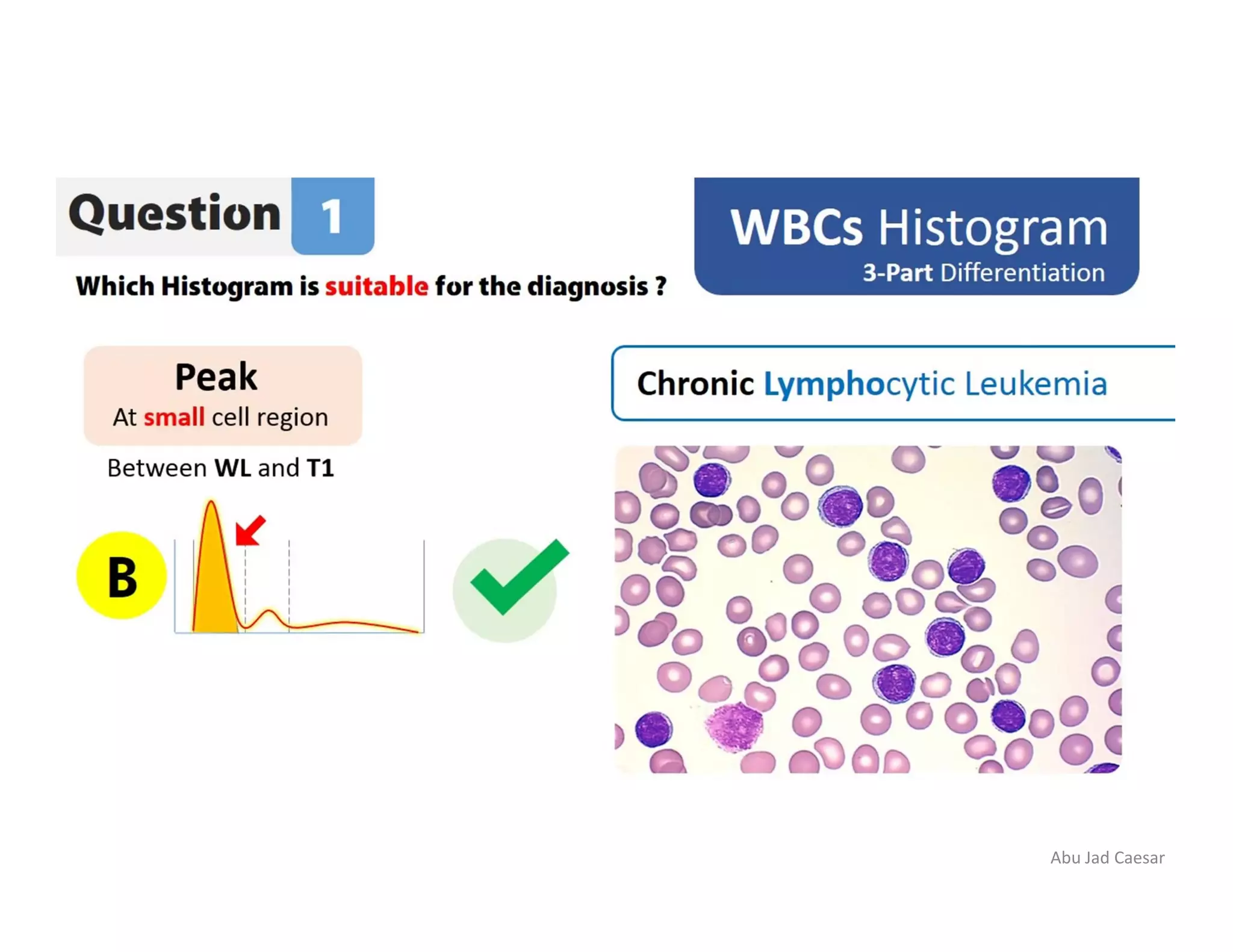 WBC Histogram | PDF