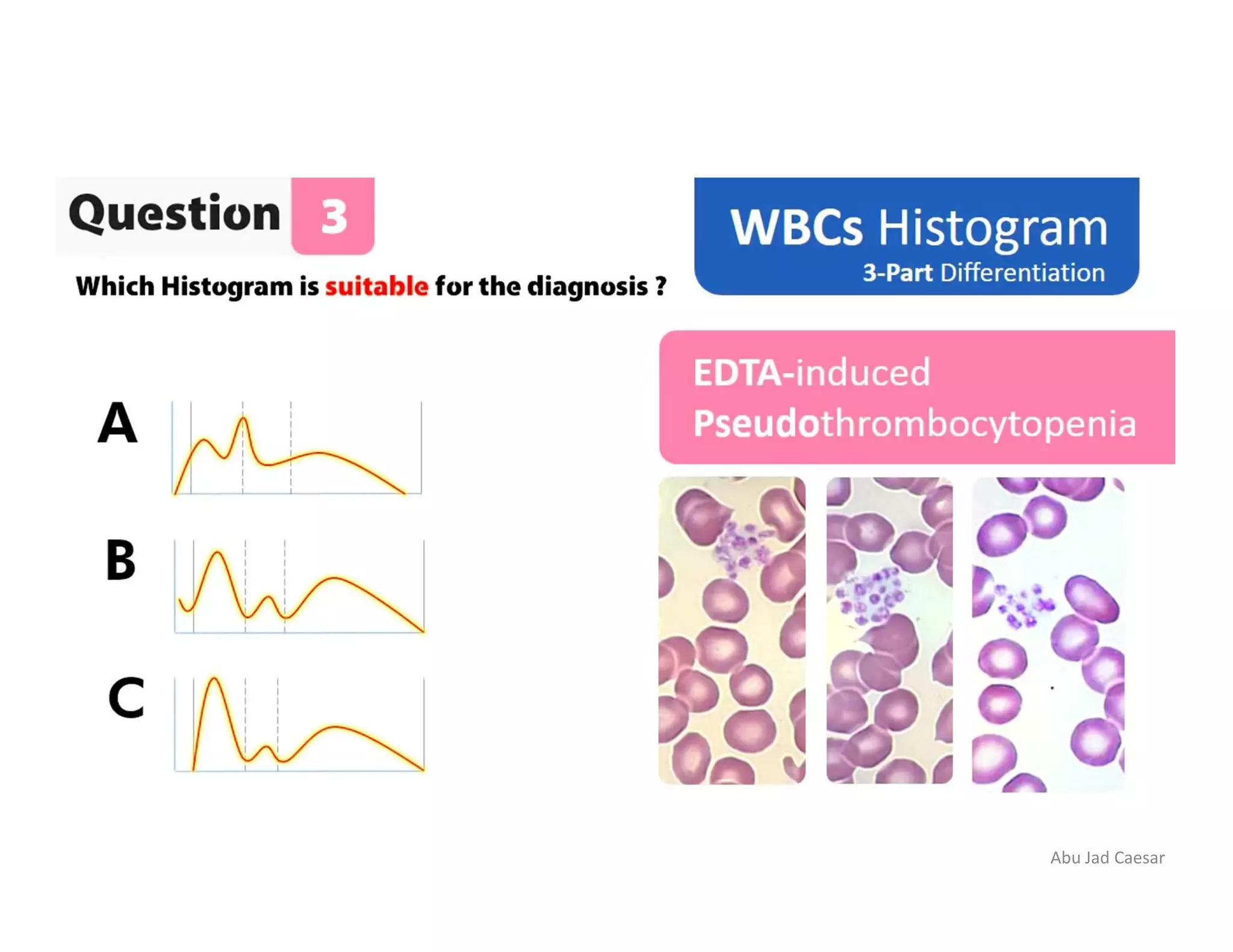 WBC Histogram | PDF