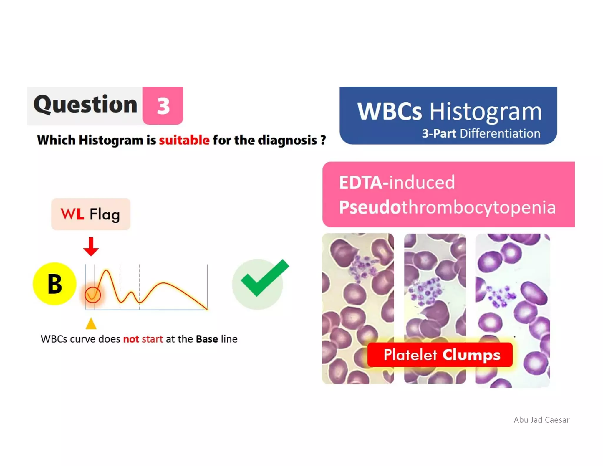 WBC Histogram | PDF
