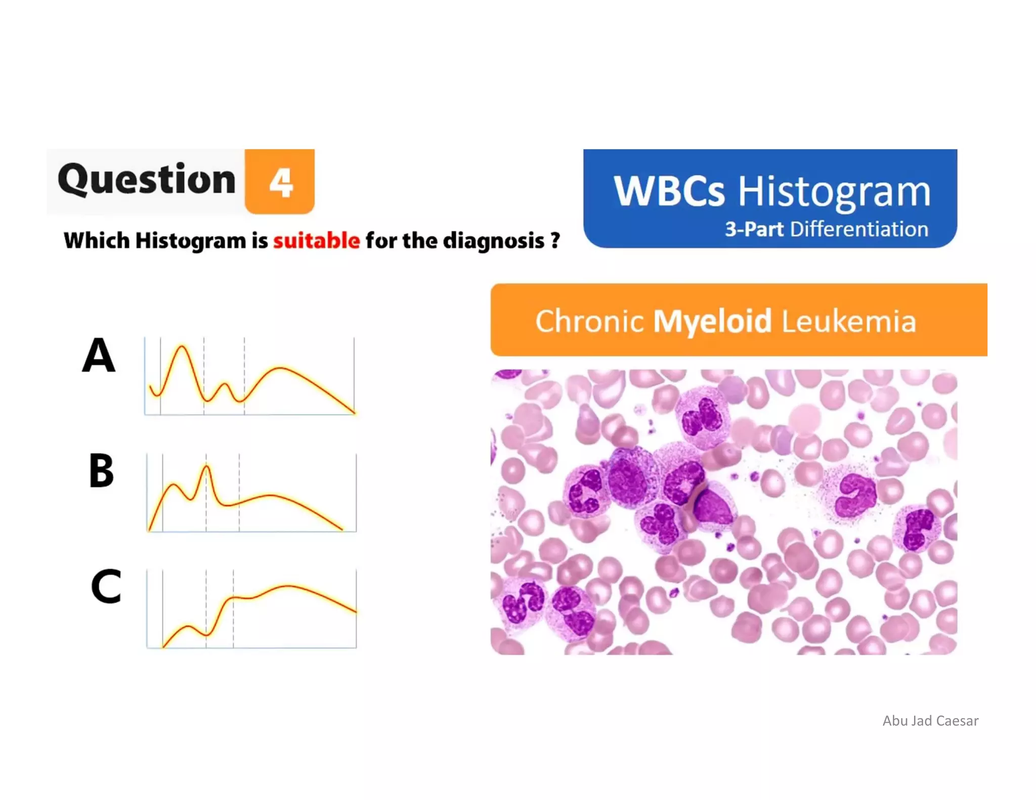 WBC Histogram | PDF