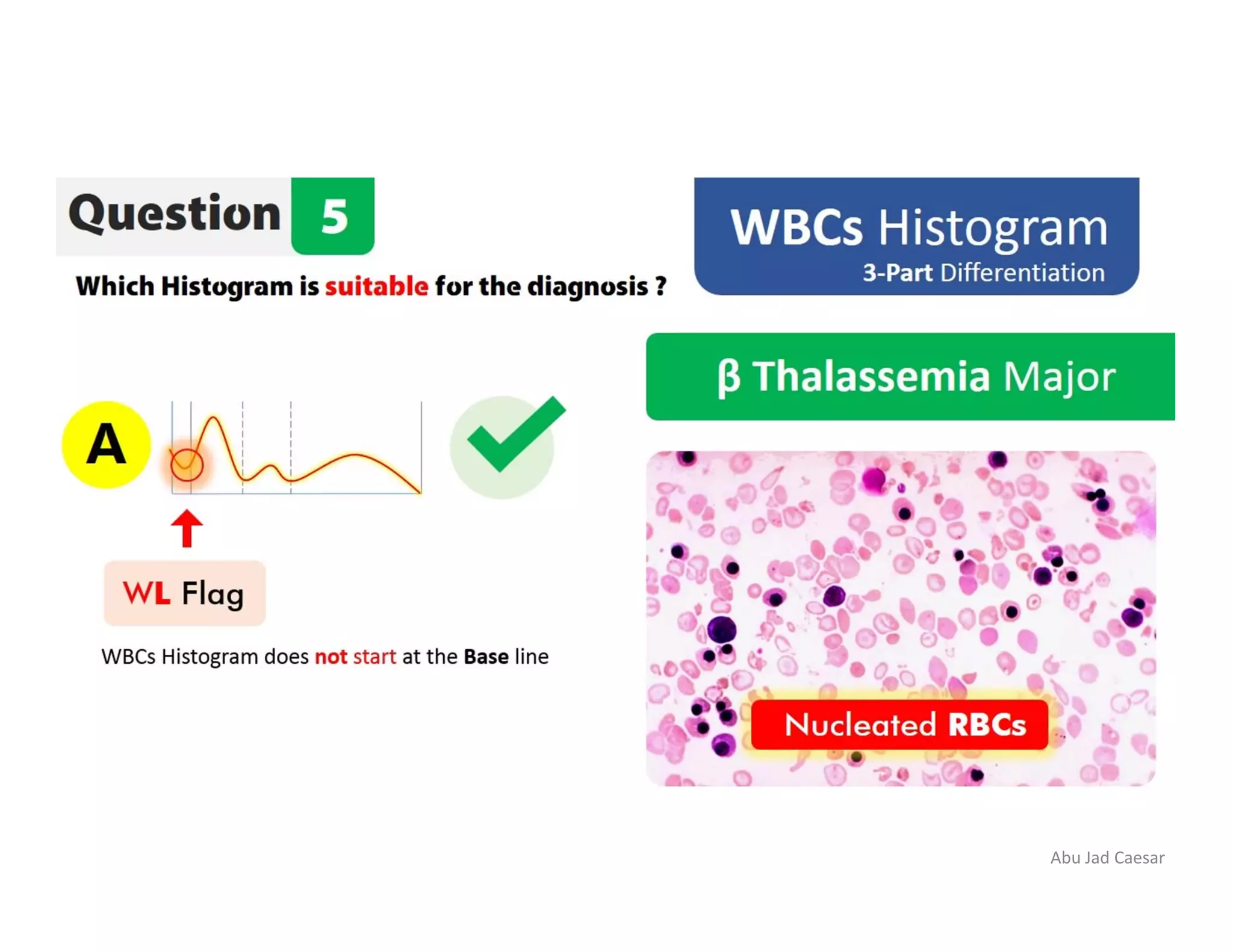 WBC Histogram | PDF