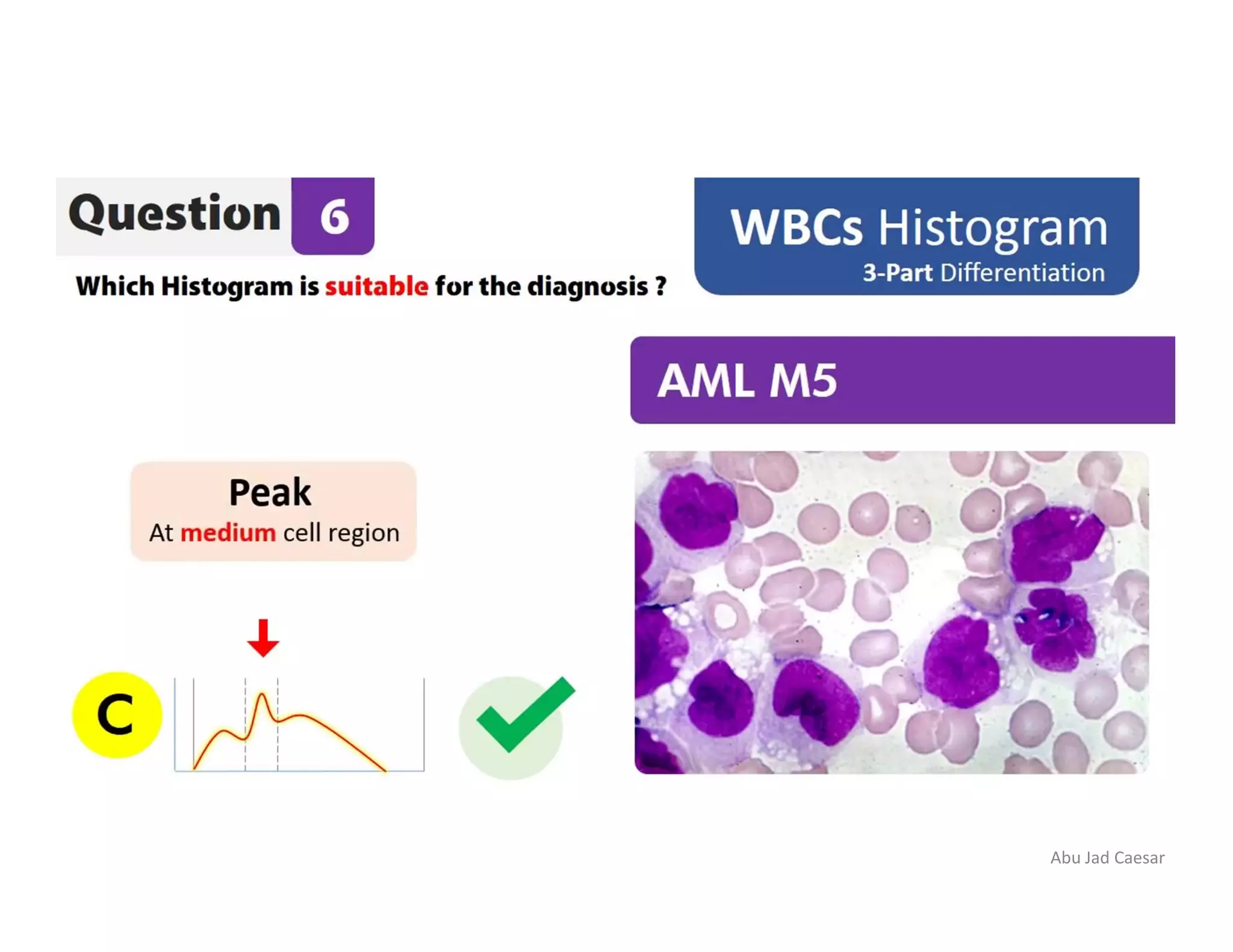 WBC Histogram | PDF
