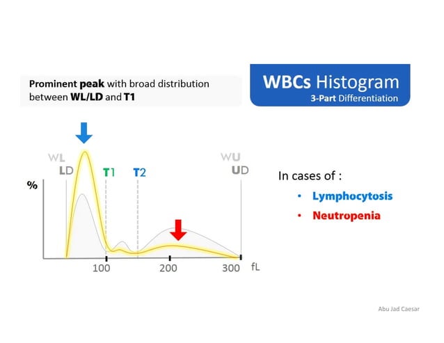 WBC Histogram