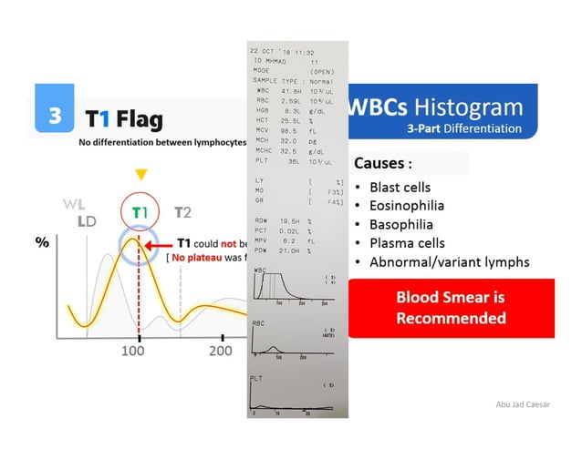 WBC Histogram