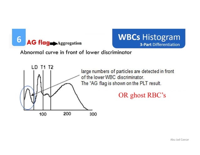 WBC Histogram