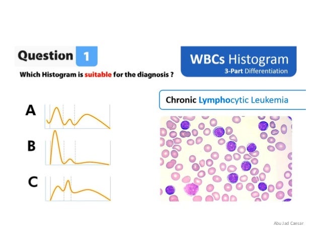 WBC Histogram