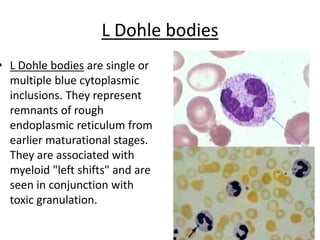 WBC normal and abnormal final.pptx