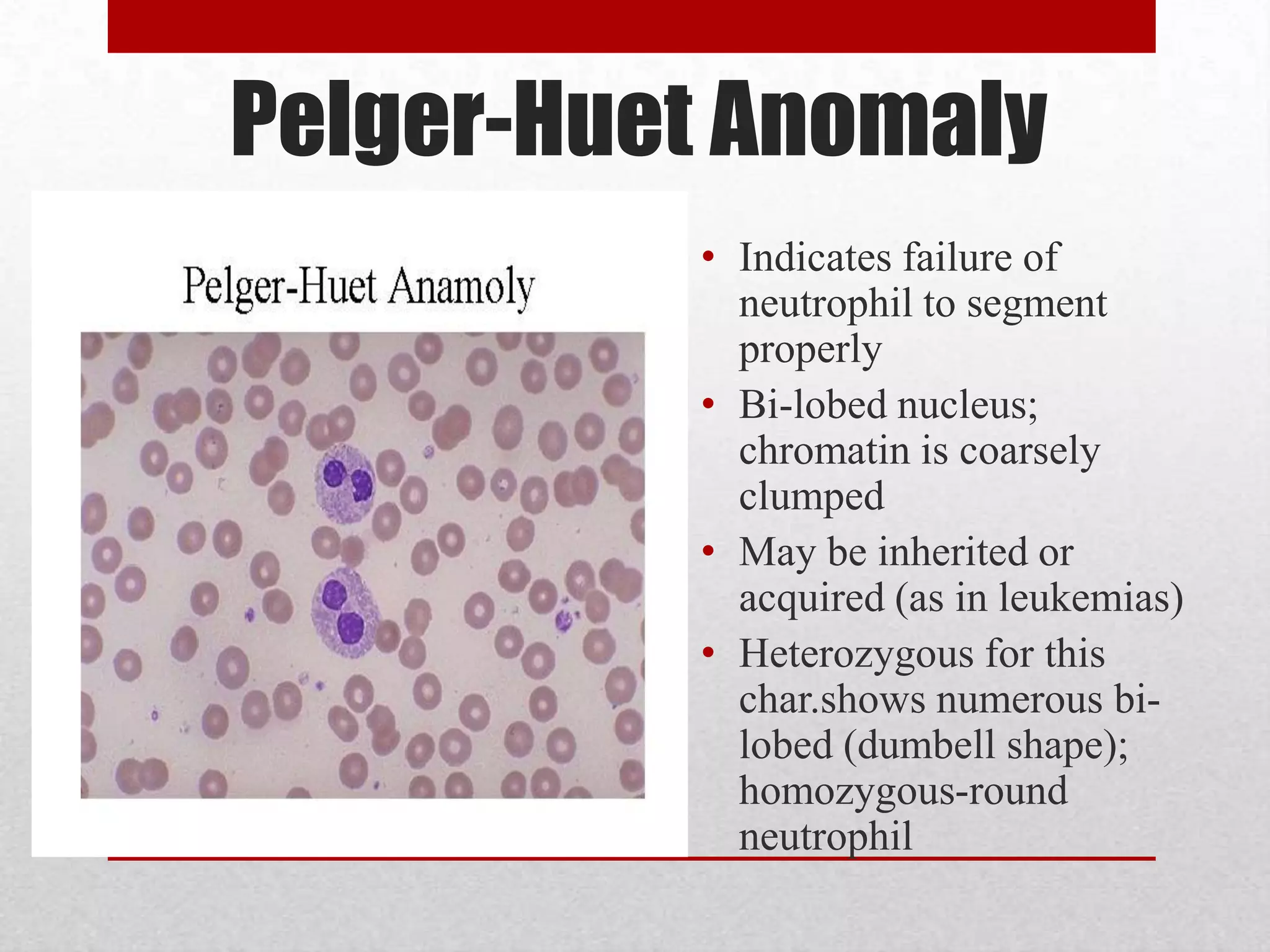 Wbc & platelets anomalies | PPTX
