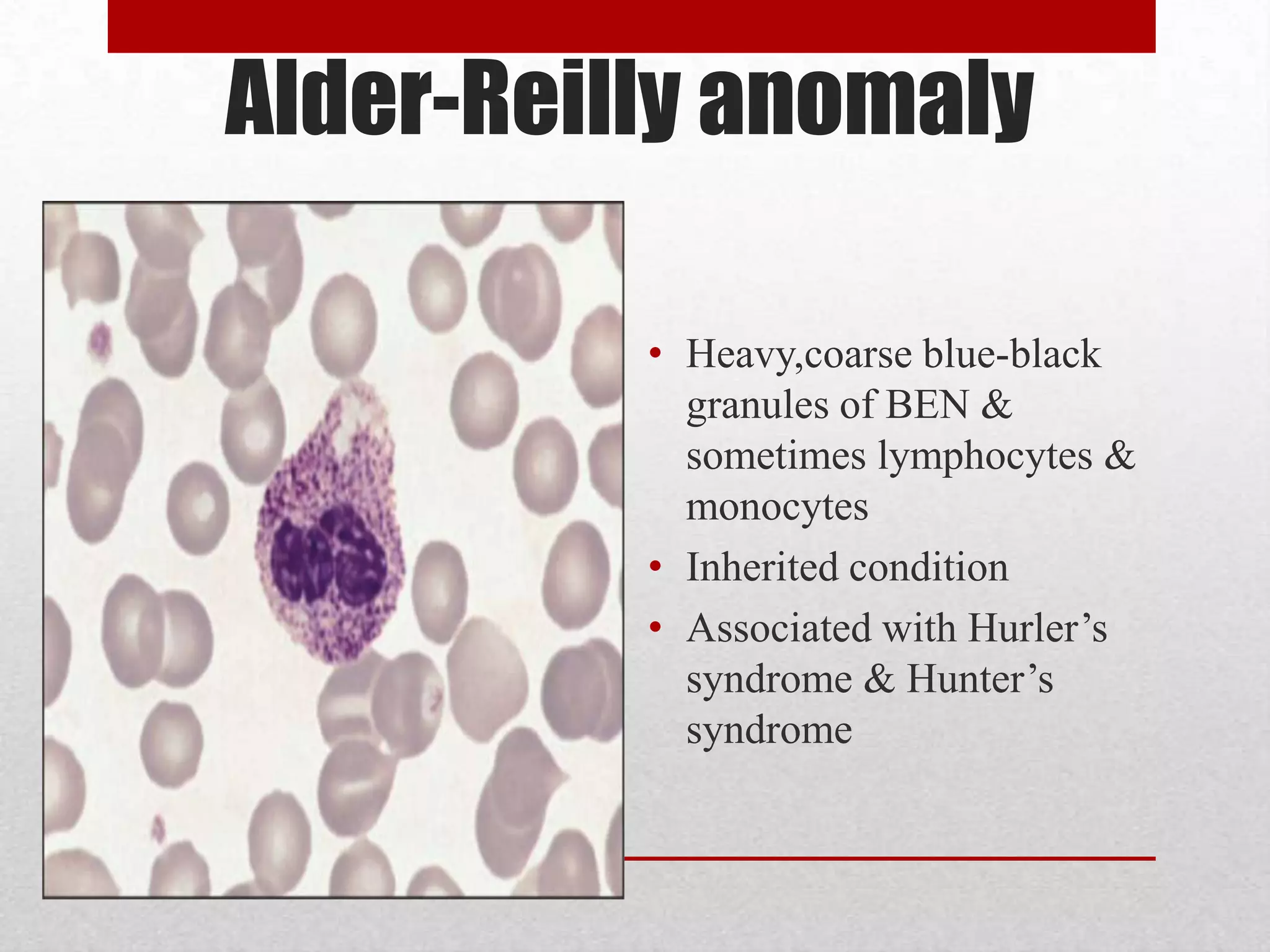 Wbc & platelets anomalies | PPTX