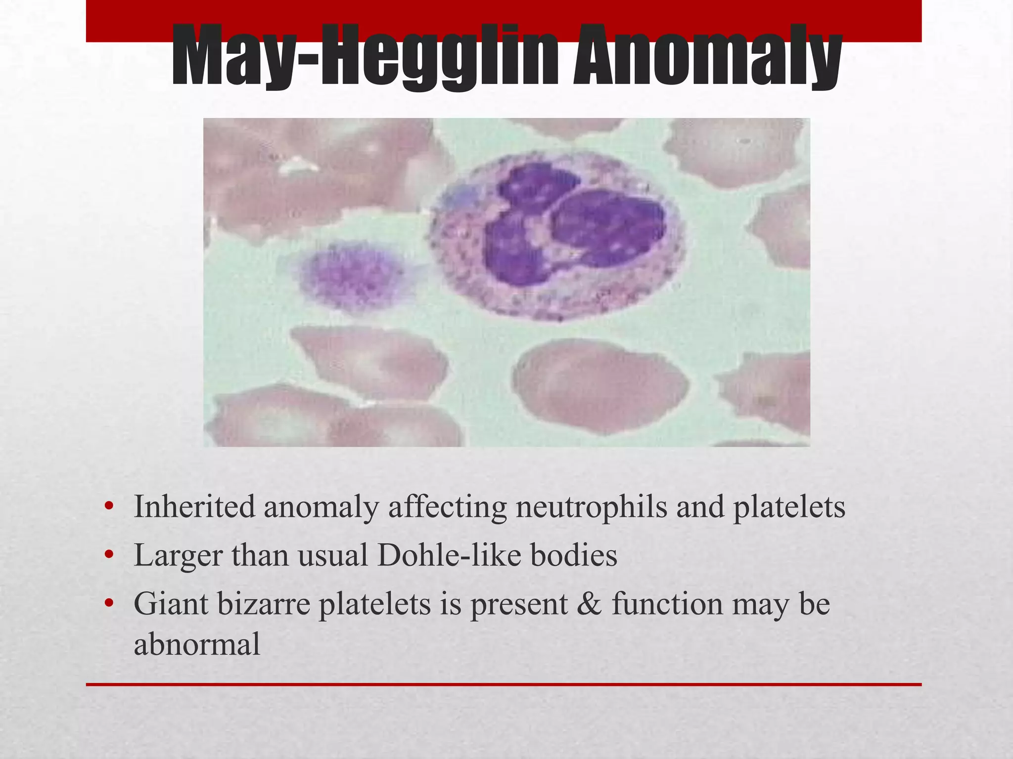 Wbc & platelets anomalies | PPTX