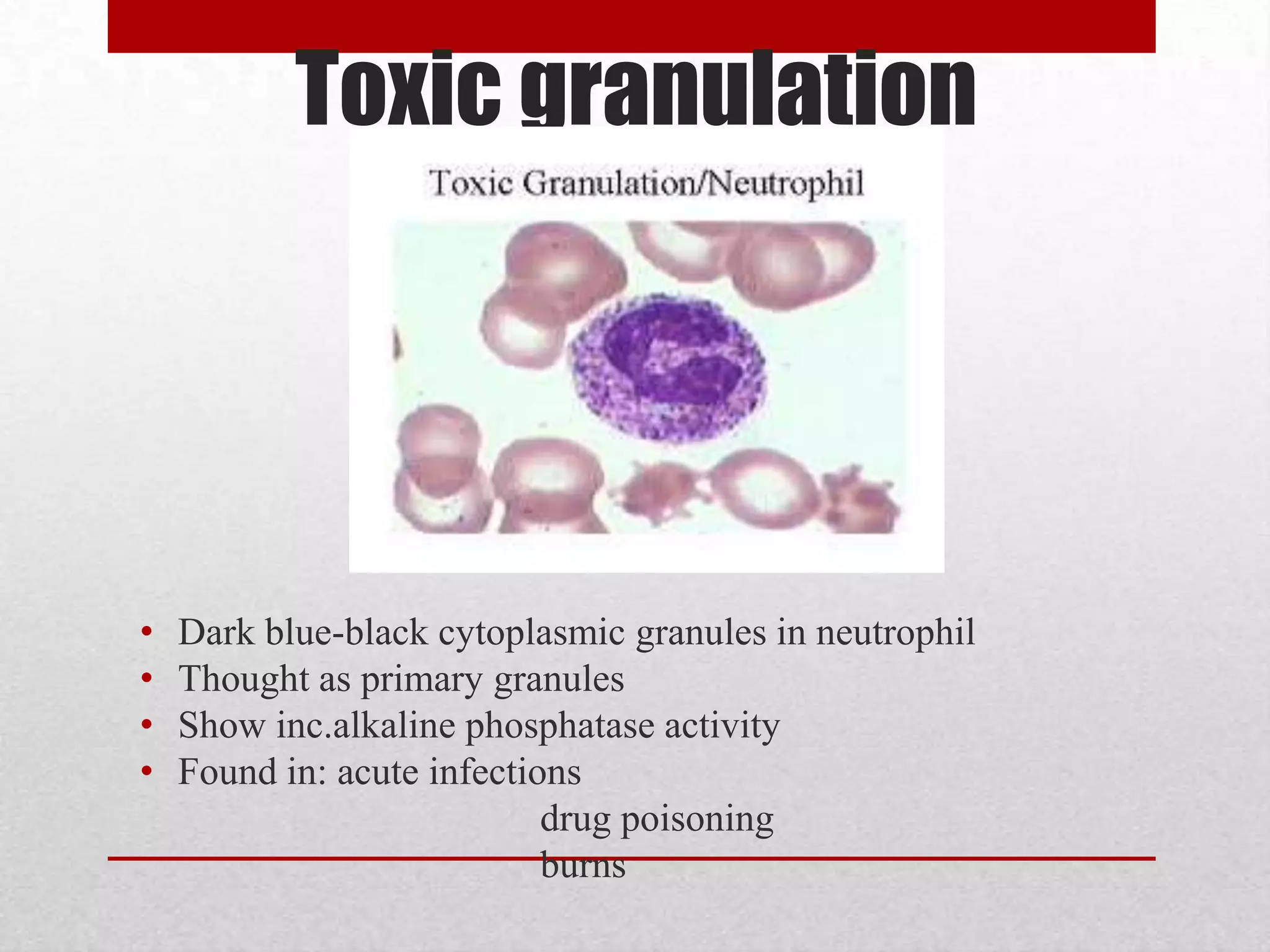 Wbc & platelets anomalies | PPTX