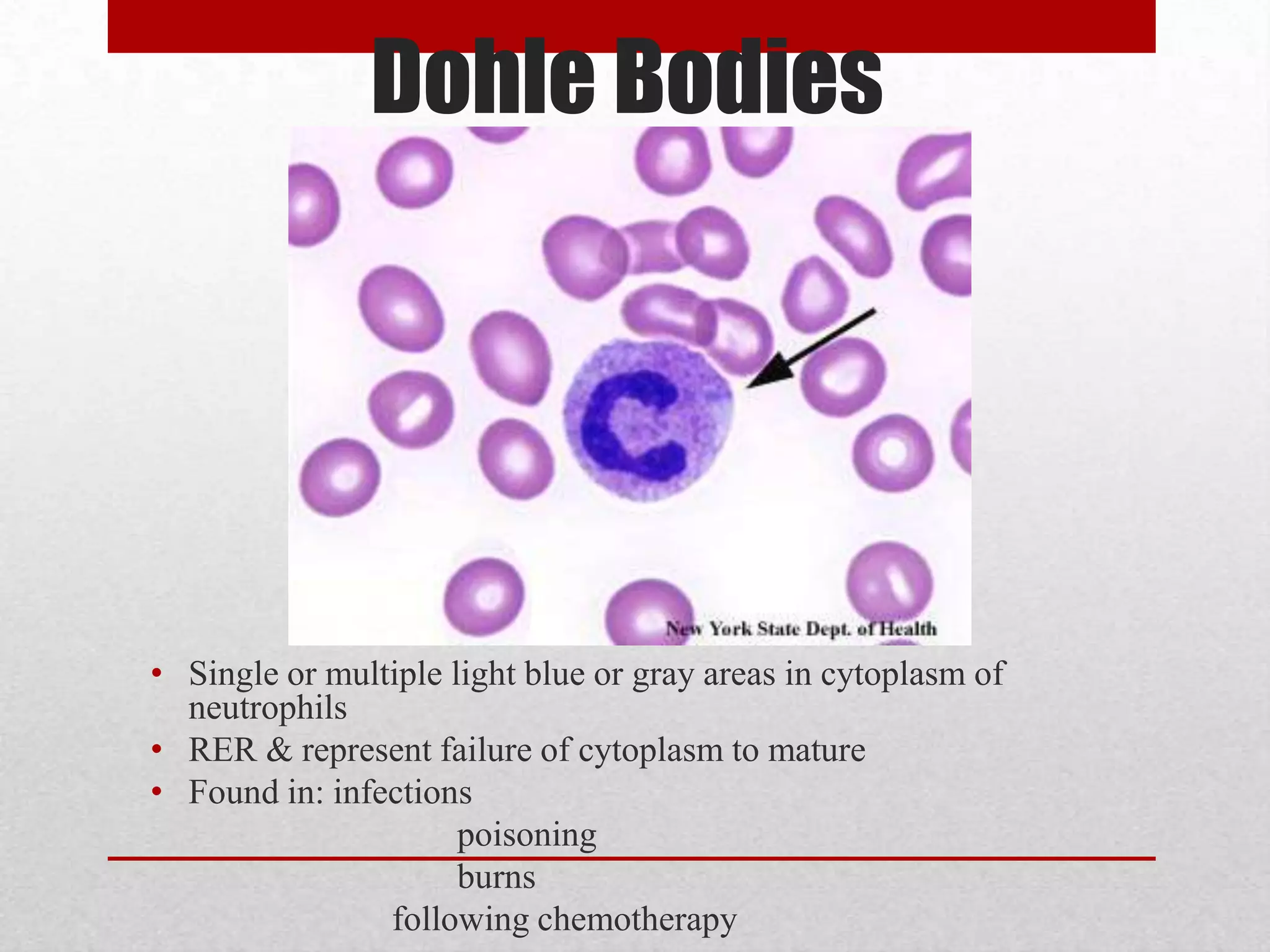 Wbc & platelets anomalies | PPTX