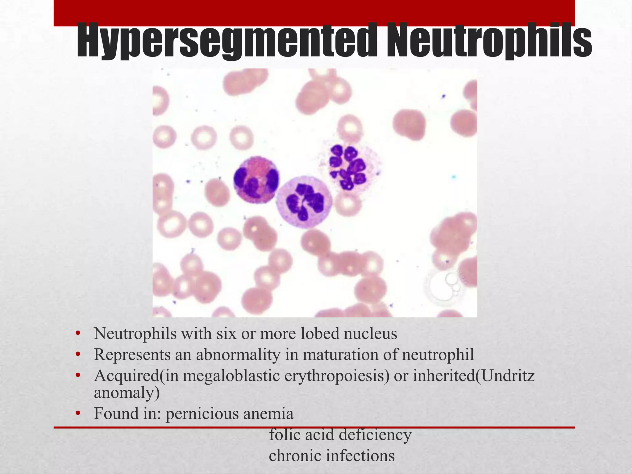 Wbc & platelets anomalies | PPTX