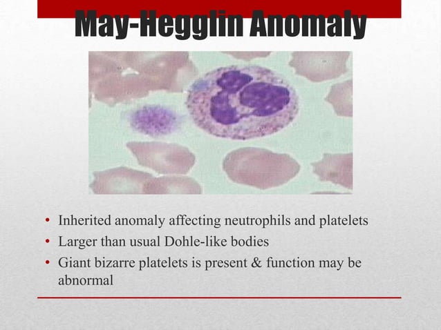 Wbc & platelets anomalies | PPTX | Blood Disorders | Diseases and ...