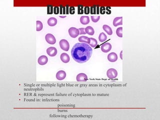 Wbc & platelets anomalies | PPTX