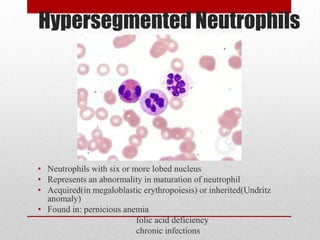 Wbc & platelets anomalies | PPTX