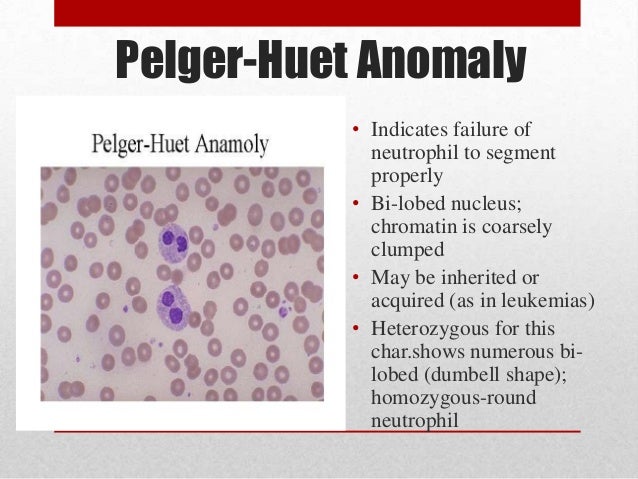 Wbc & platelets anomalies