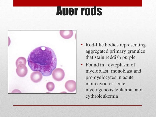 Wbc & platelets anomalies
