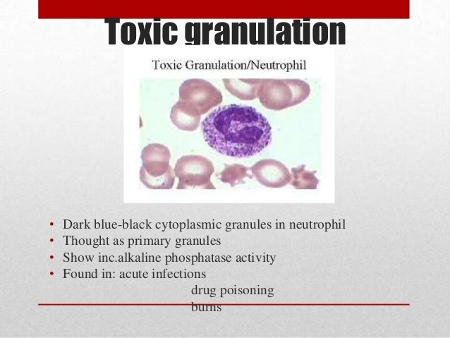 Wbc & platelets anomalies