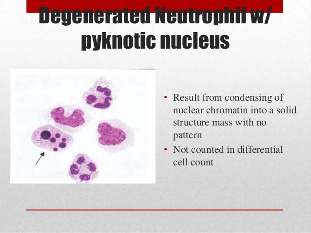 Wbc & platelets anomalies