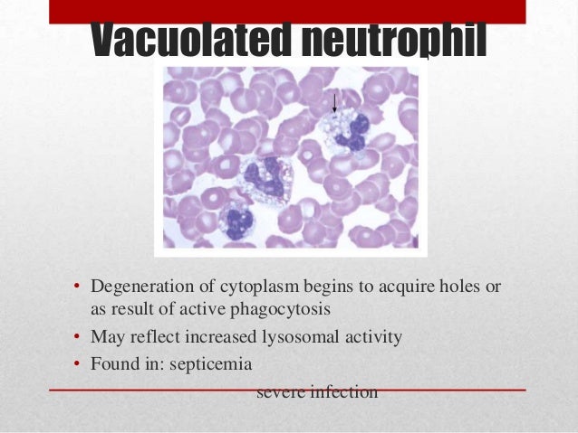 Wbc & platelets anomalies