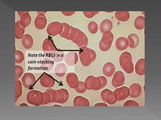 Wbc rbc | PPTX | Blood Disorders | Diseases and Conditions