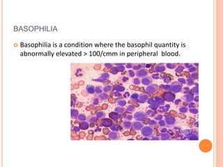 Wbc's disorders | PPTX