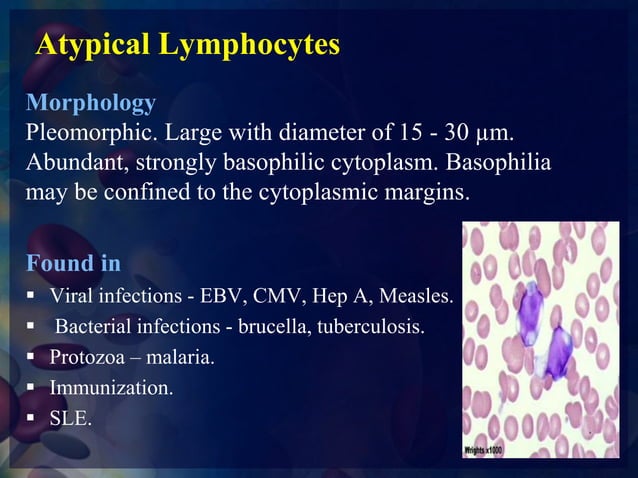 WBCs, LEUKEMIA.pptx