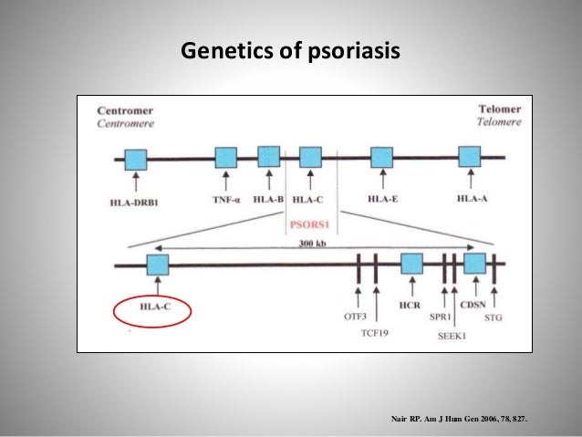 Psoriasis