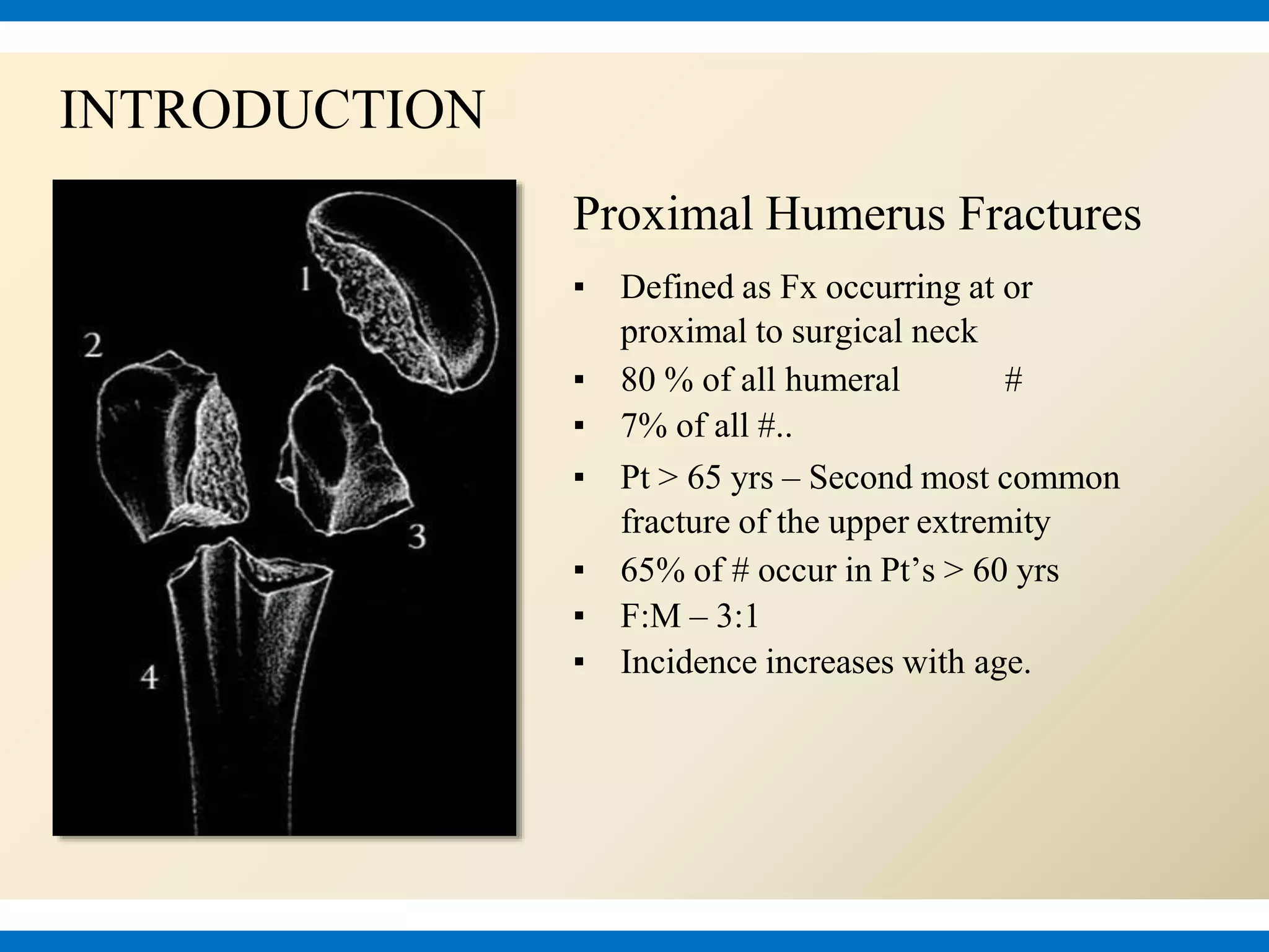 MIPO TECHNIQUE FOR PROXIMAL HUMERUS FRACTURE | PPTX