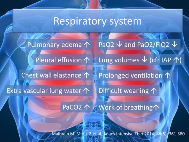 WCACS2017 FLUID OVERLOAD.pptx
