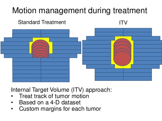 Technical Advances in radiotherapy for Lung (and liver) Cancer