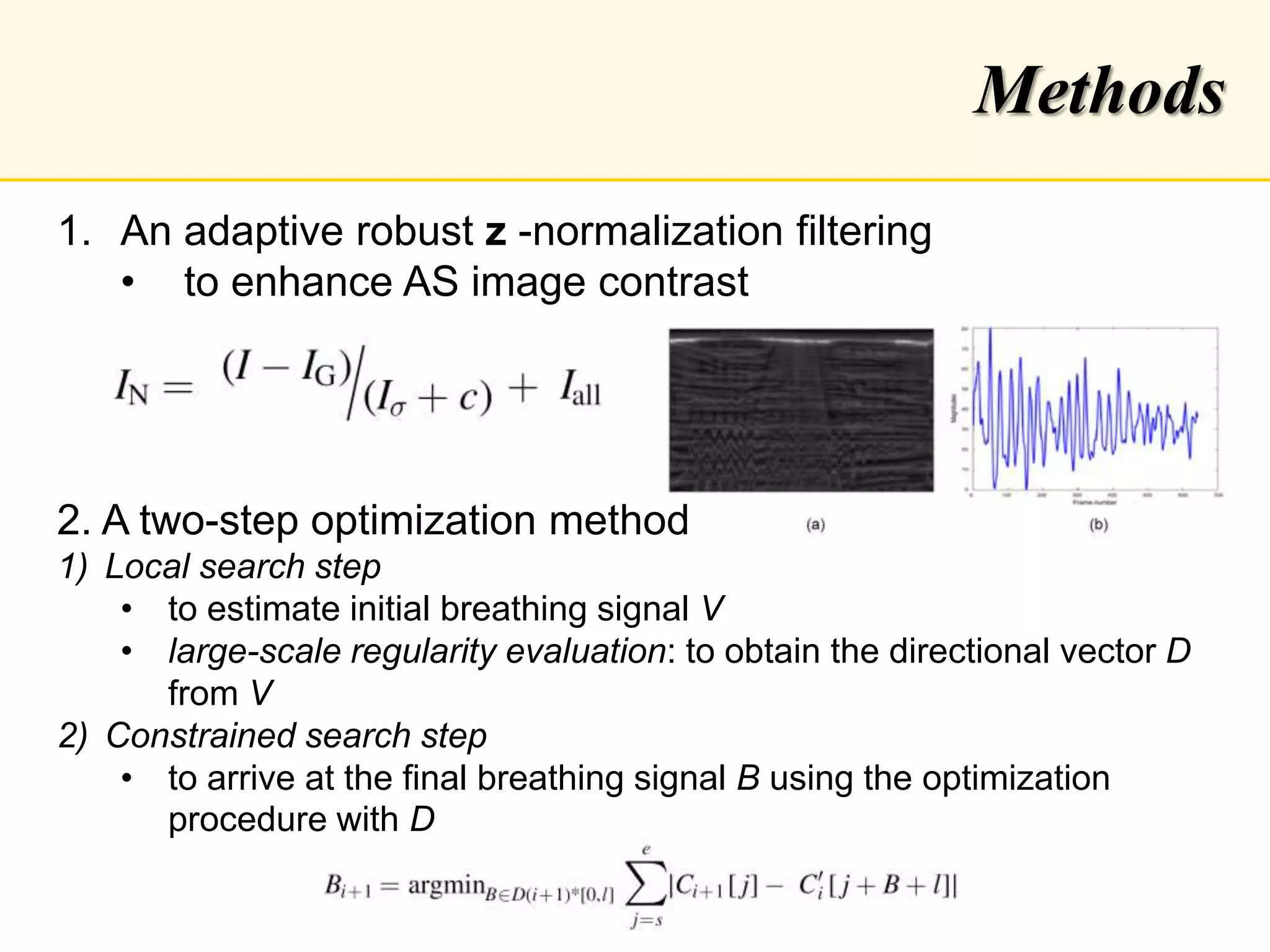 Robust breathing signal extraction from cone beam CT projections based ...