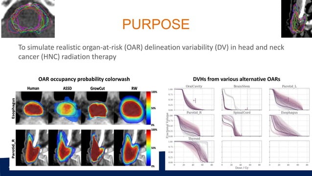 Simulation of Realistic Organ-At-Risk Delineation Variability in Head ...